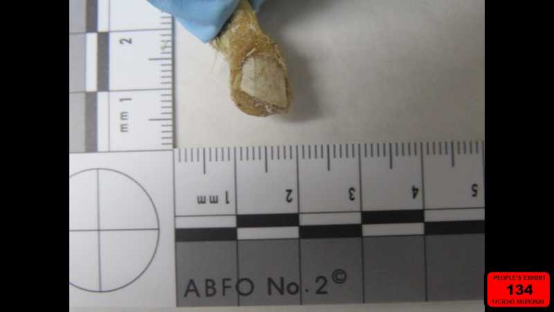 Dylan Redwine Crime Scene Photos: Bones, Clothes & Possible Toe Found ...