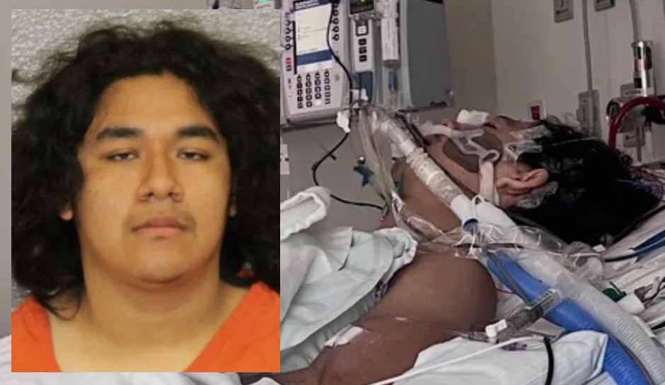 Teen Shot in the Face by ‘Friend’ Who Brought Guns to Sleepover – Crime ...